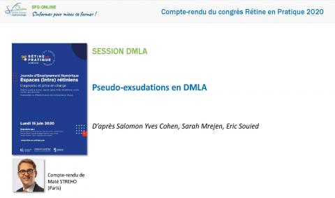 dmla exsudative